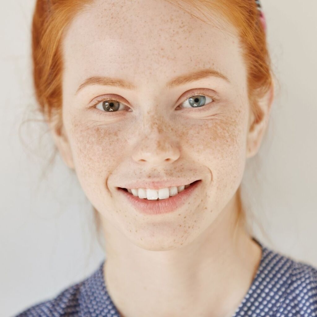 Frekles & Pigmentation - La Fameux Derma